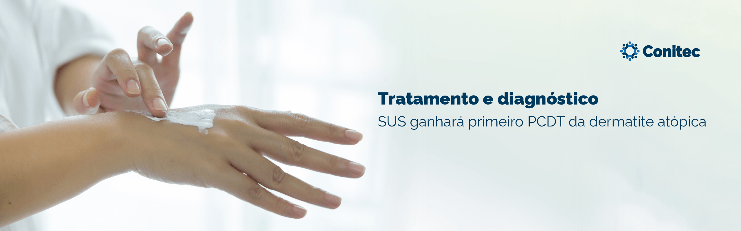 SUS ganhará primeiro PCDT para tratamento da dermatite atópica ...